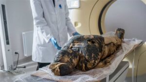 Ancient Egyptian fetus preserved due to unusual decomposition process