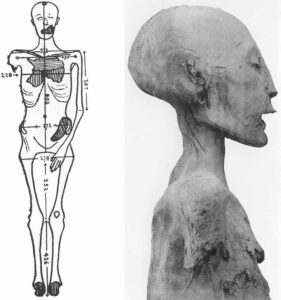 The Younger Lady: The Possible Mother of Tutankhamun